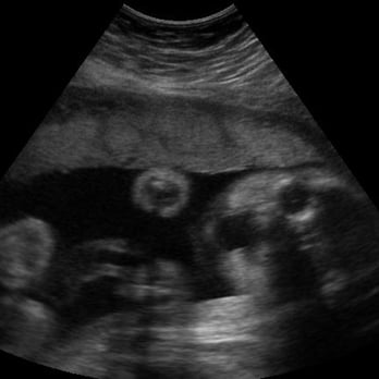 Fetal Memories 2D 3D 4D Ultrasound - 81 Photos & 203 Reviews ...