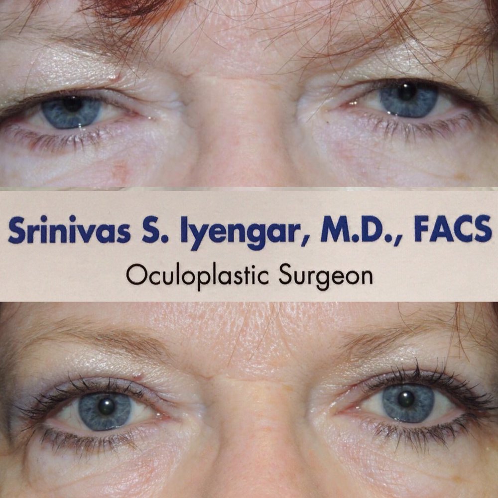 San Diego Eyelid Specialists - 86 Photos & 49 Reviews - Cosmetic ...