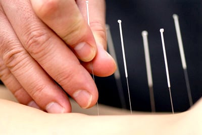 China Acupuncture Clinic - 10 Photos & 15 Reviews - Acupuncture - 3740 ...