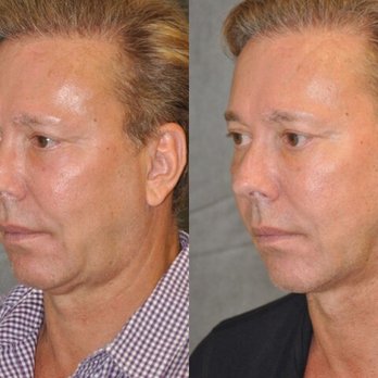 Ben Talei, MD - 85 Photos & 102 Reviews - Cosmetic Surgeons - 465 N ...